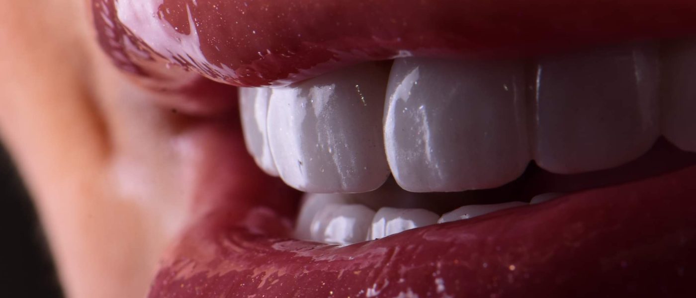 Hollywood Smile en Algérie à Blida - Cabinet dentaire Kara Mostefa